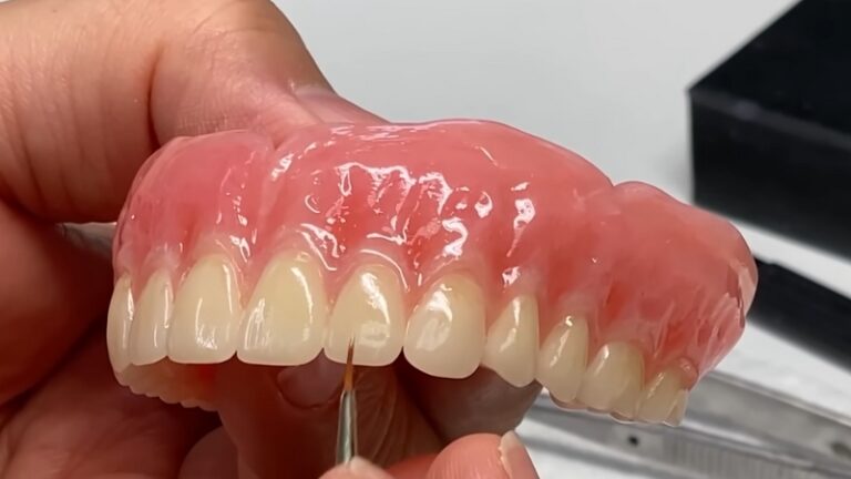 Zubne proteze - Sve što treba da znate